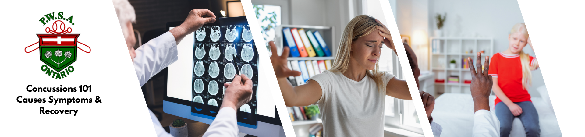 Concussion 101 - Causes, Symptoms & Recovery - Ontario PWSA